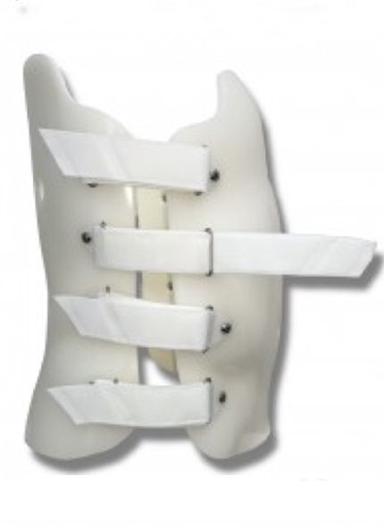 Thoracolumbosacral Orthosis (TLSO) - Cascade Orthotics Calgary